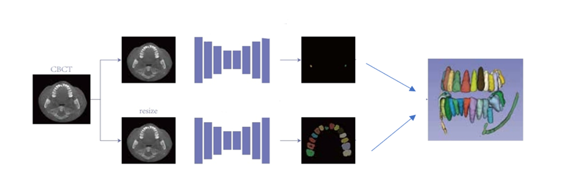 3d Tooth Segmentation Is Faster On Intel® Xeon® Scalable Processor