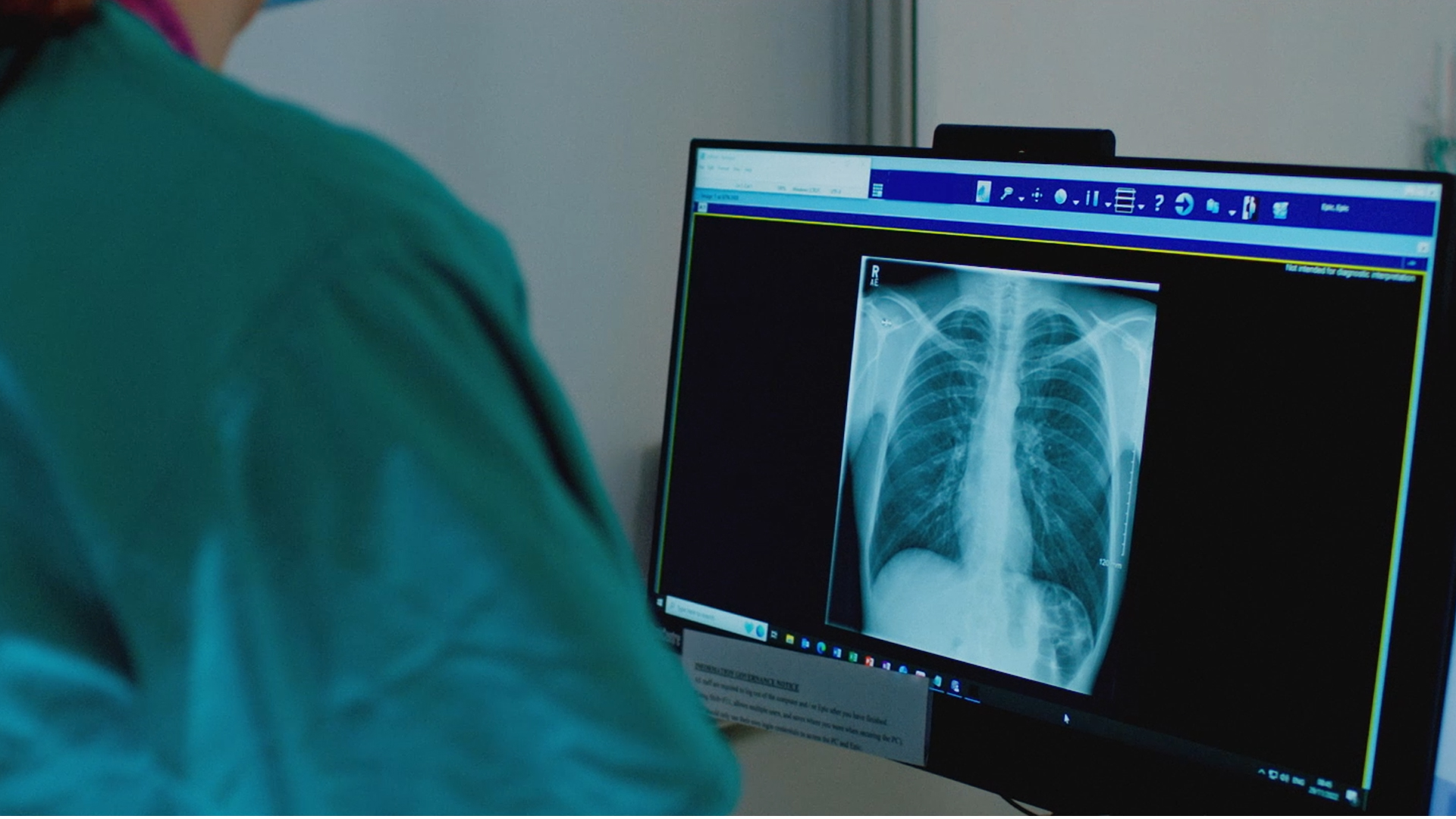 AIX-COVNET: AI and Visualization Fight COVID-19